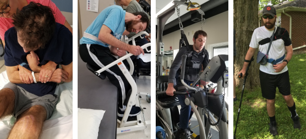Physical Medicine and Rehabilitation: Treating Spasticity